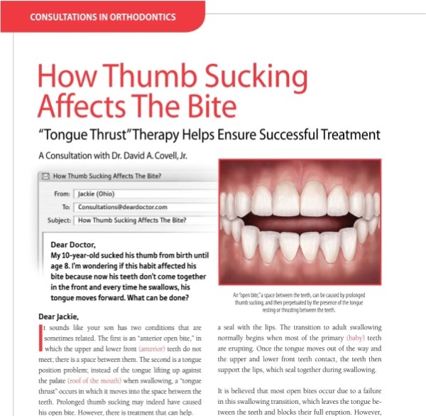 Early Orthodontic Treatment | E.L. Dellinger Orthodontics