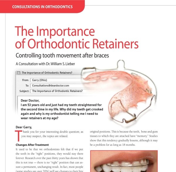 Post-Orthodontic Care | E.L. Dellinger Orthodontics