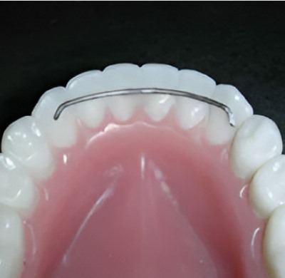 Retention Phase | E.L. Dellinger Orthodontics